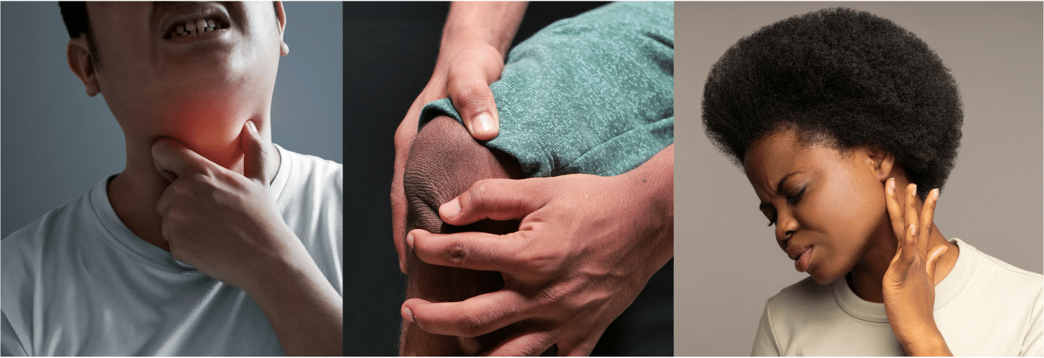 Chronic Fatigue Syndrome Causes, Symptoms, and Treatments - Agape ...