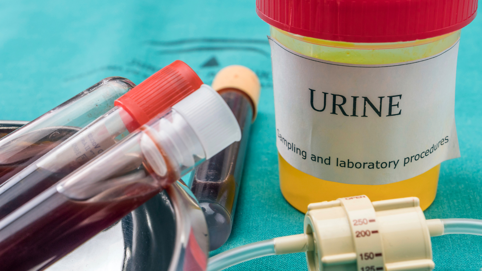 Lupus Symptoms, Diagnosis, and Treatment Options - Agape Family Health