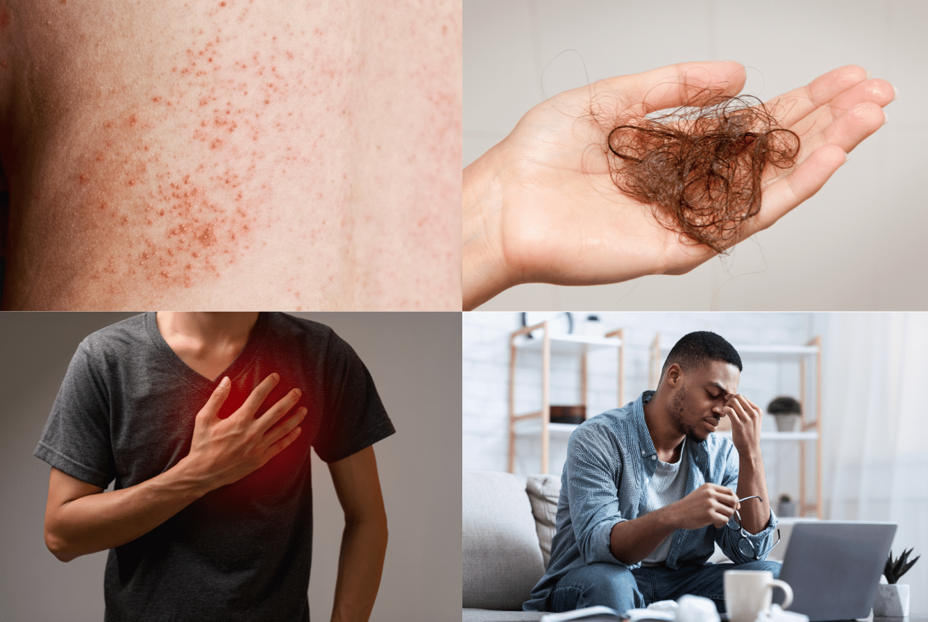 Lupus Symptoms, Diagnosis, and Treatment Options - Agape Family Health